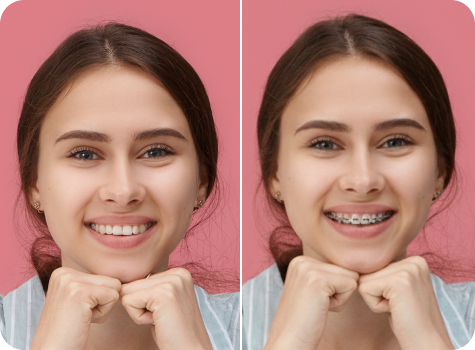 Free AI braces filter online (No login, no signup)